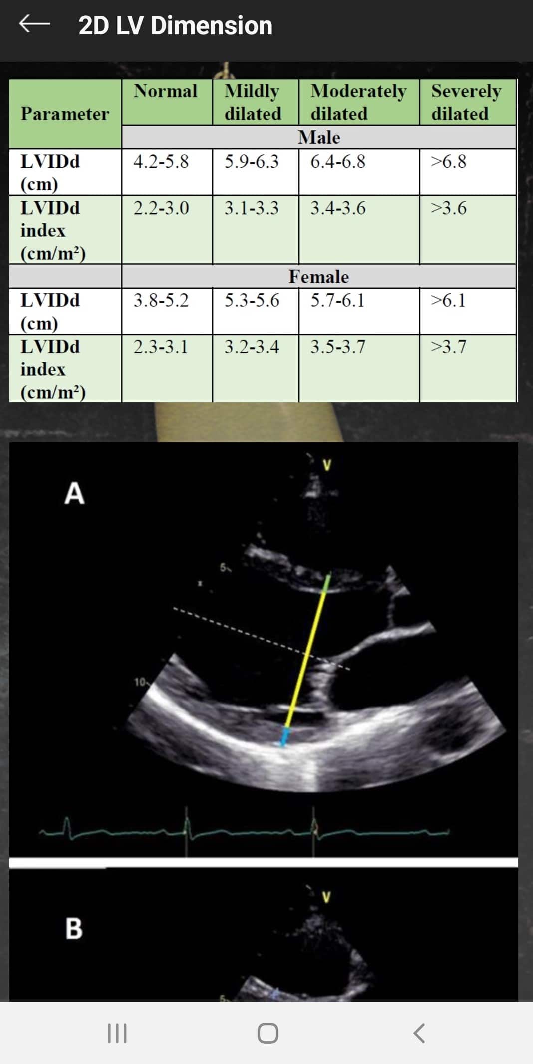 Echocompanion - Dr. Ghazal